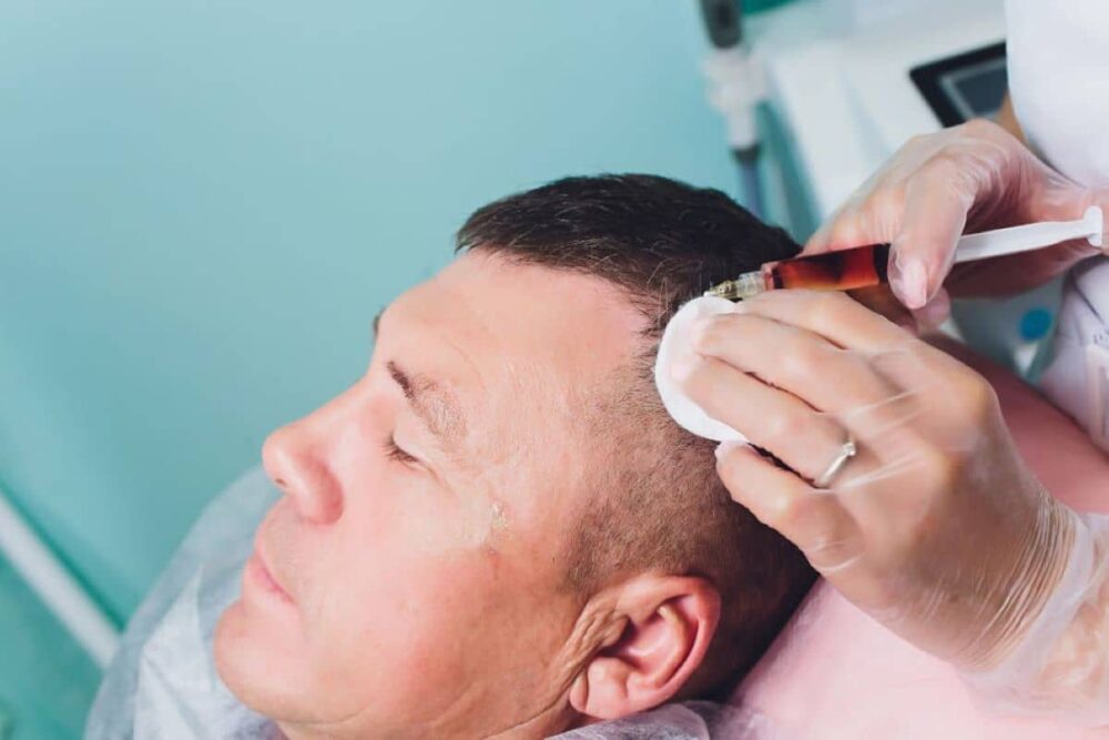 Die 5 besten Hausmittel gegen Haarausfall